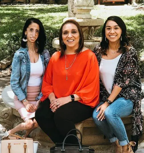 Is Lizzie Velasquez Married? Details On Boyfriend, Net Worth, Family